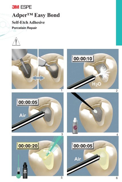 Adper Easy Bond - Porcelain Repair - 3M