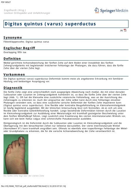 Digitus quintus (varus) superductus - Engelhardt Lexikon ...