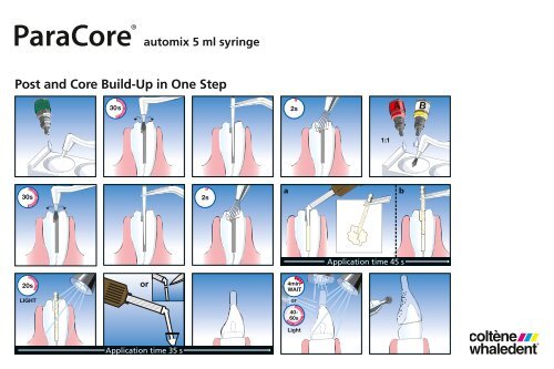 Post and Core Build-Up in One Step - MEDIPRO
