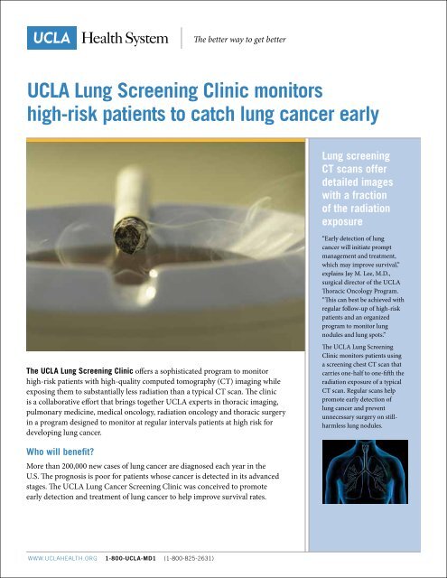 Print Clinic Brochure (PDF) - Lung Cancer Program - UCLA