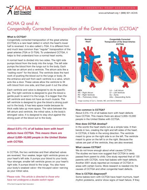 CCTGA - Adult Congenital Heart Association