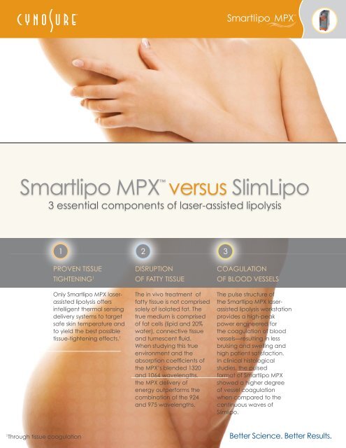 Smartlipo MPX v Slimlipo