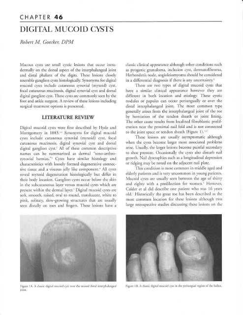DIGITAL MUCOID CYSTS - The Podiatry Institute