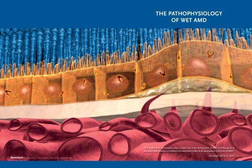 THE PATHOPHYSIOLOGY OF WET AMD - Lucentis