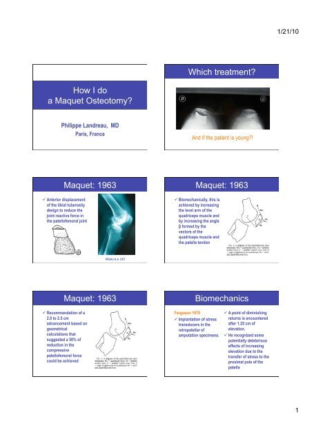 How I do a Maquet Osteotomy? - 5th Advanced Course on Knee ...