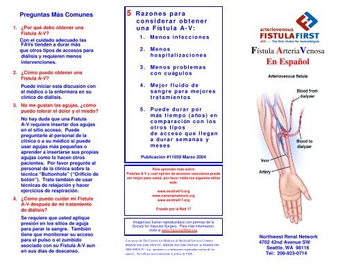 Fistula First Brochure - Espanol - FINAL VERSION NW16 12-08