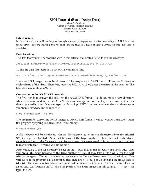 SPM Tutorial - Center for Advanced Brain Imaging - Nathan Kline ...