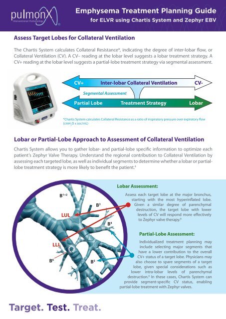 Treatment Planning Guide - Pulmonx