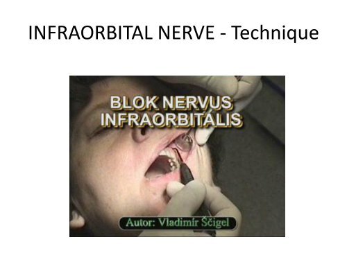 INFRAORBITAL