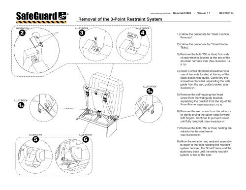 3-Point Removal - SafeGuard