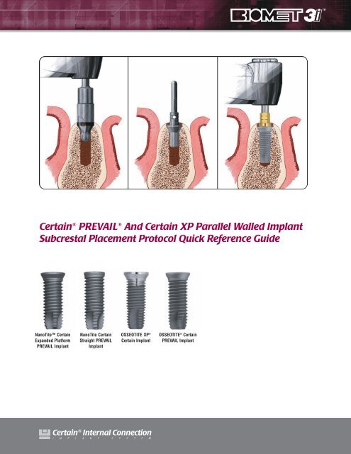 CertainÂ® PREVAILÂ® And Certain XP Parallel Walled ... - Biomet 3i