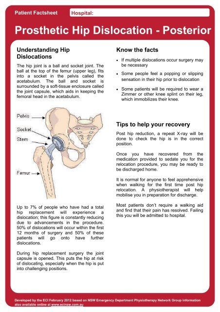 Posterior Hip Dislocation Presentation