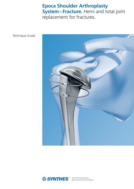 Epoca Shoulder Arthroplasty System Synthes, 53% OFF