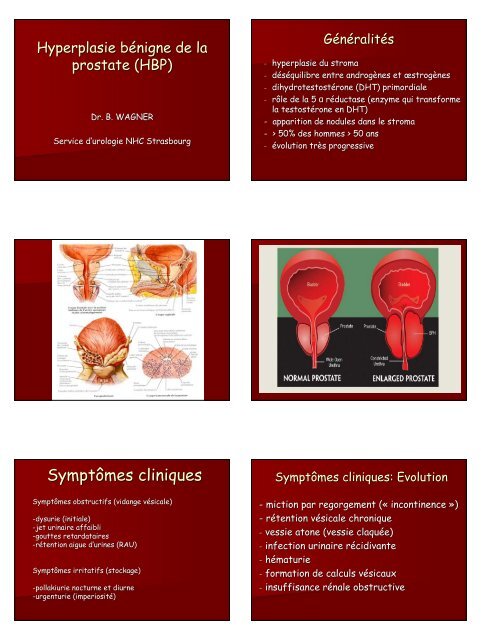 Hyperplasie bÃ©nigne de la prostate