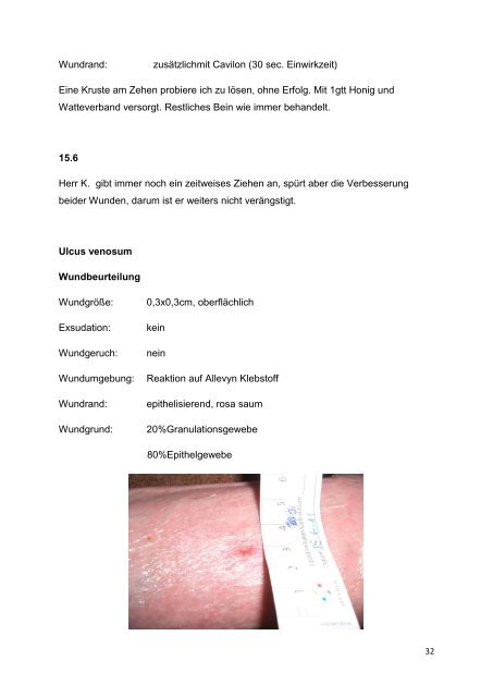 Wundrand: zusätzlichmit