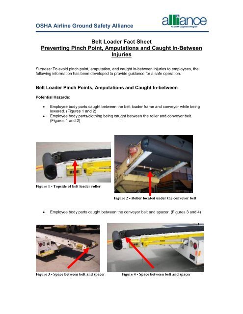 Preventing Pinch Point, Amputations and Caught In-Between Injuries