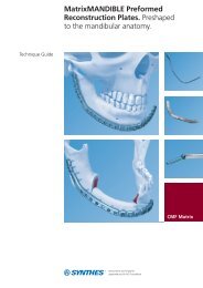 MatrixMANDIBLE. The next generation mandible plating ... - Synthes