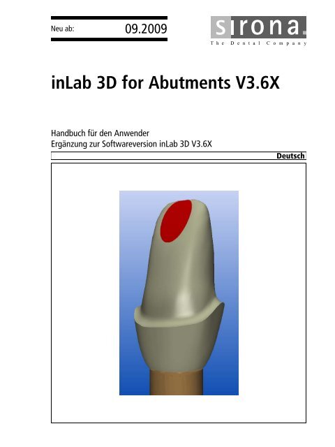 inLab 3D for Abutments V3.6X