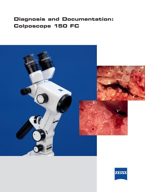 Diagnosis and Documentation: Colposcope 150 FC - Optronik