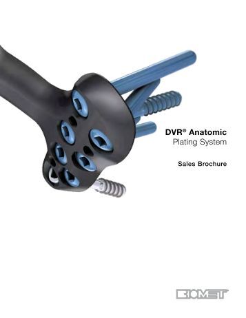 Percutaneous pins versus