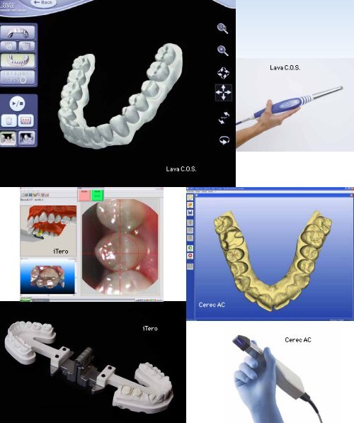 iTero iTero Lava COS Cerec AC Cerec AC Lava COS - JDT Unbound