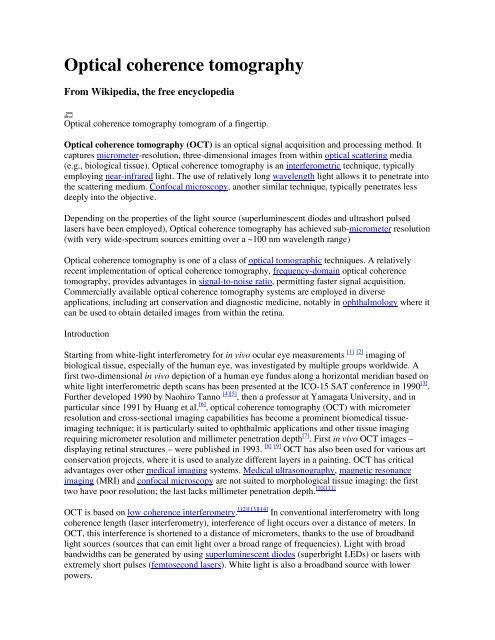 Optical coherence tomography - Amedeolucente.It