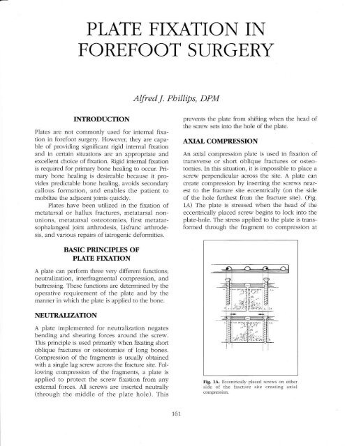 Plate fixation in Foot Surgery - The Podiatry Institute
