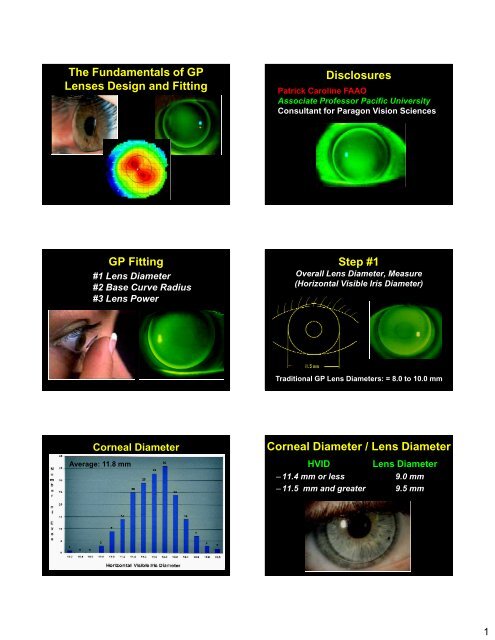 The Fundamentals of GP Lenses Design and Fitting Disclosures GP ...
