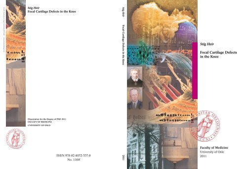 Stig Heir Focal Cartilage Defects in the Knee