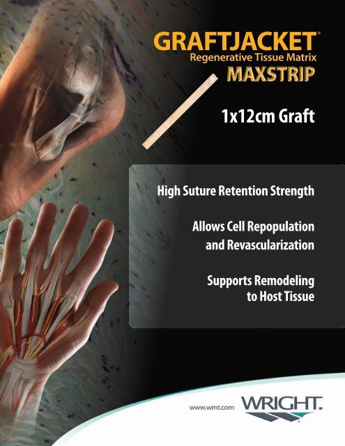GRAFTJACKET - Wright Medical Technology, Inc.