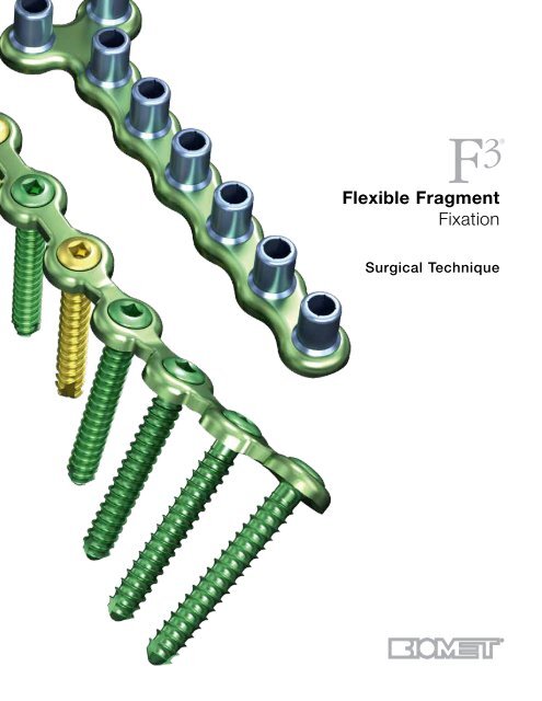 F3Ã‚Â® Flexible Fragment Fixation Surgical Technique - Biomet