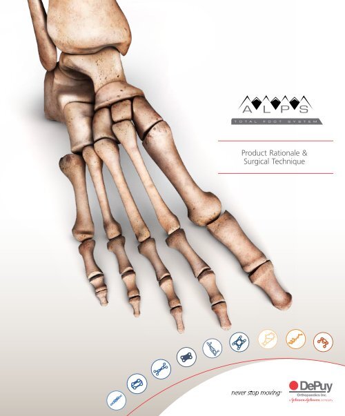 A.L.P.S. Total Foot System Product Rationale & Surgical ... - Biomet