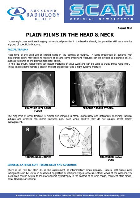 PLAIN FILMS IN THE HEAD & NECK - Auckland Radiology Group