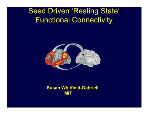 Seed Driven 'Resting State' Functional Connectivity - Neurometrika