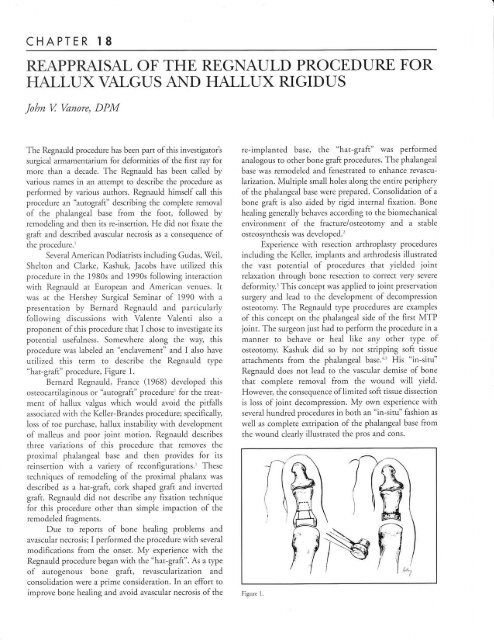 Reappraisal of the Regnauld Procedure for Hallux Valgus and