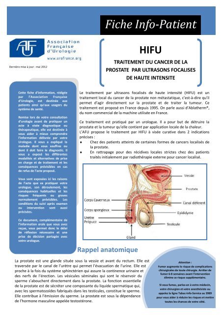 Document PDF - Urofrance