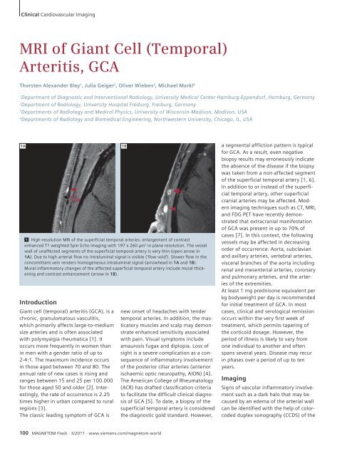 MRI of Giant Cell (Temporal) Arteritis, GCA - Siemens Healthcare