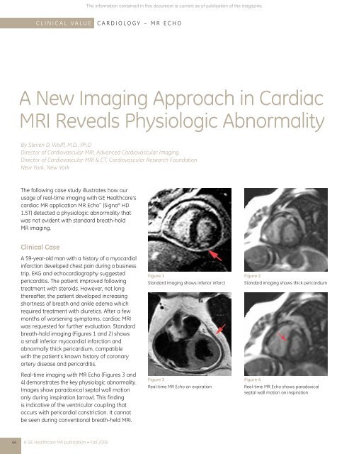 A New Imaging Approach in Cardiac MRI Reveals ... - GE Healthcare