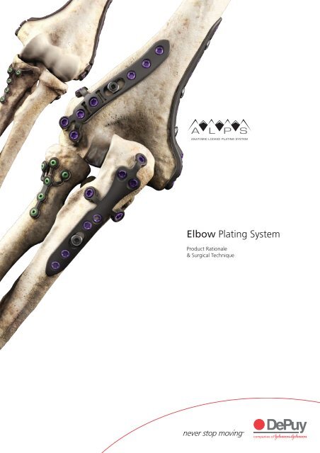 Elbow Plating System Product Rationale & Surgical ... - Biomet