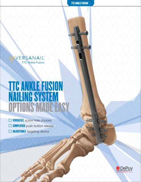 VersaNailÃ‚Â® TTC Fusion System Brochure - Biomet