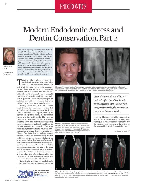 Modern Endodontic Access and Dentin Conservation, Part 2 (David ...