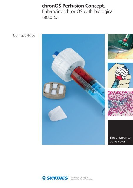 chronOS Perfusion Concept. Enhancing chronOS ... - Osteosyntese