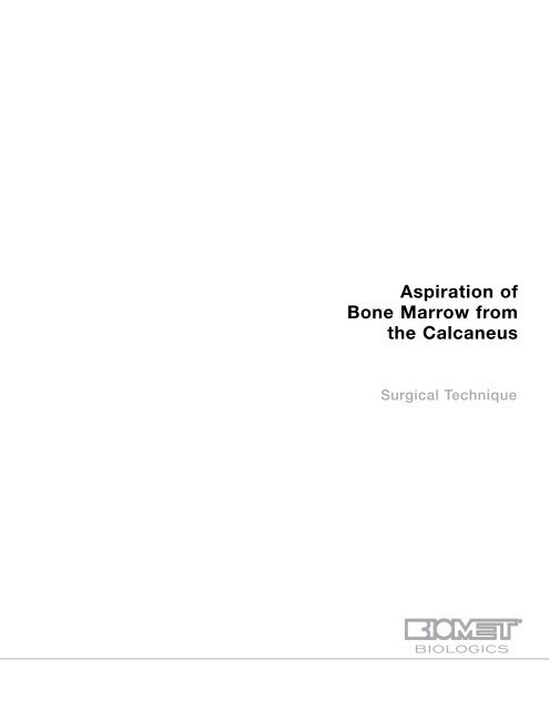 Aspiration of Bone Marrow from the Calcaneus - Biomet