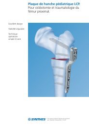 Système d'ostéosynthèse à tiges et mâchoires (CRIF ... - Synthes