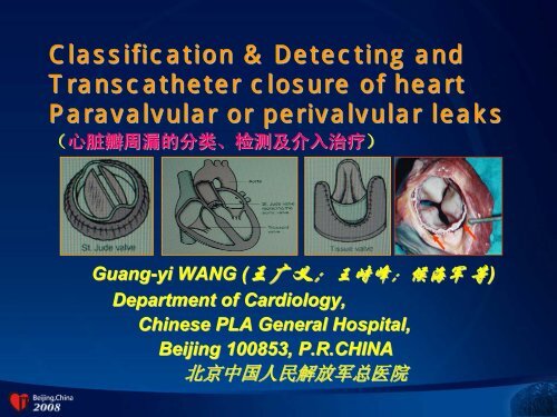 Paravalvular or perivalvular
