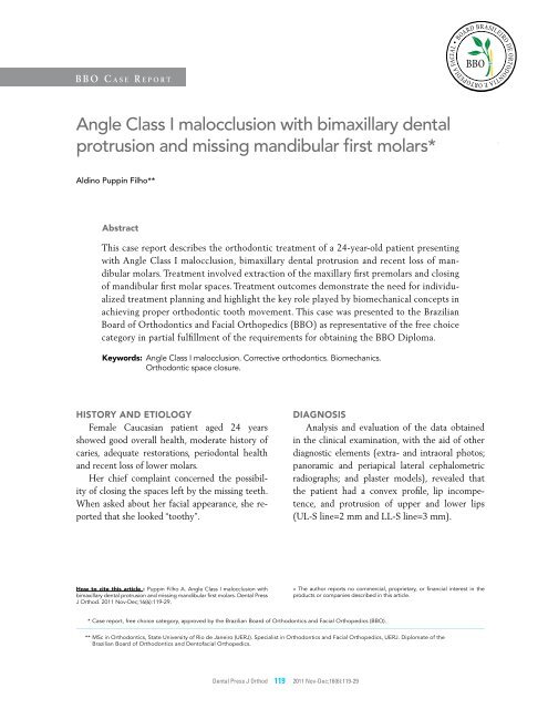 Angle Class I malocclusion with bimaxillary dental ... - Dental Press