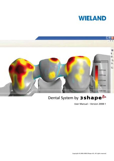 Dental System by 3 shape - Wieland Dental