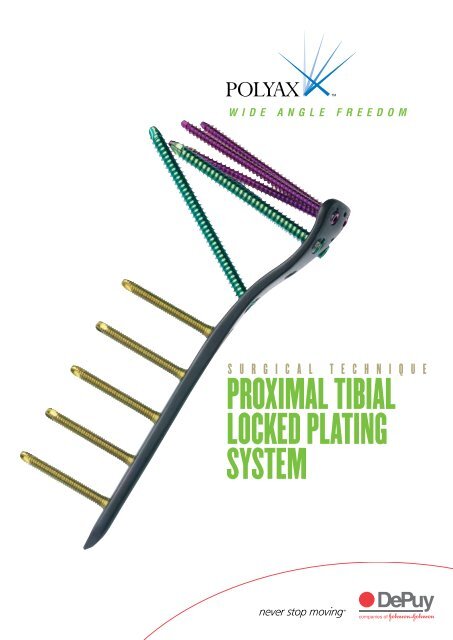 PolyAx Proximal Tibia Surgical Technique English - Biomet