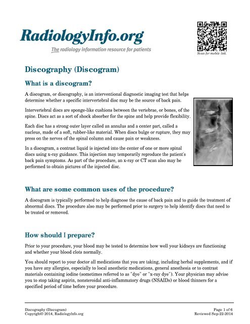 Discography (Discogram) - RadiologyInfo