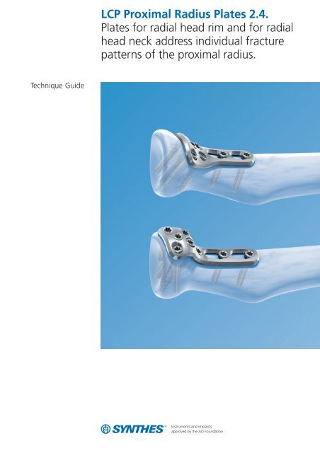 LCP Proximal Radius Plates 2.4. Plates for radial head rim and for ...